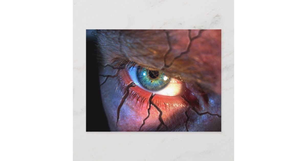 Cracked Eye Postcard | Zazzle