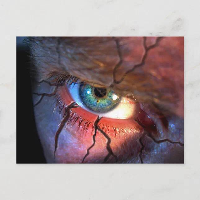 Cracked Eye Postcard | Zazzle