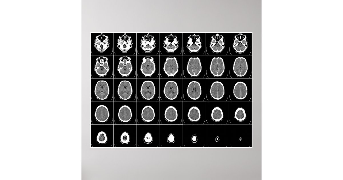 CT SCAN of HEAD Poster | Zazzle