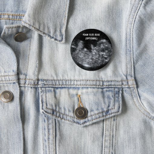 Custom Baby Ultrasound Picture Pinback Button | Zazzle