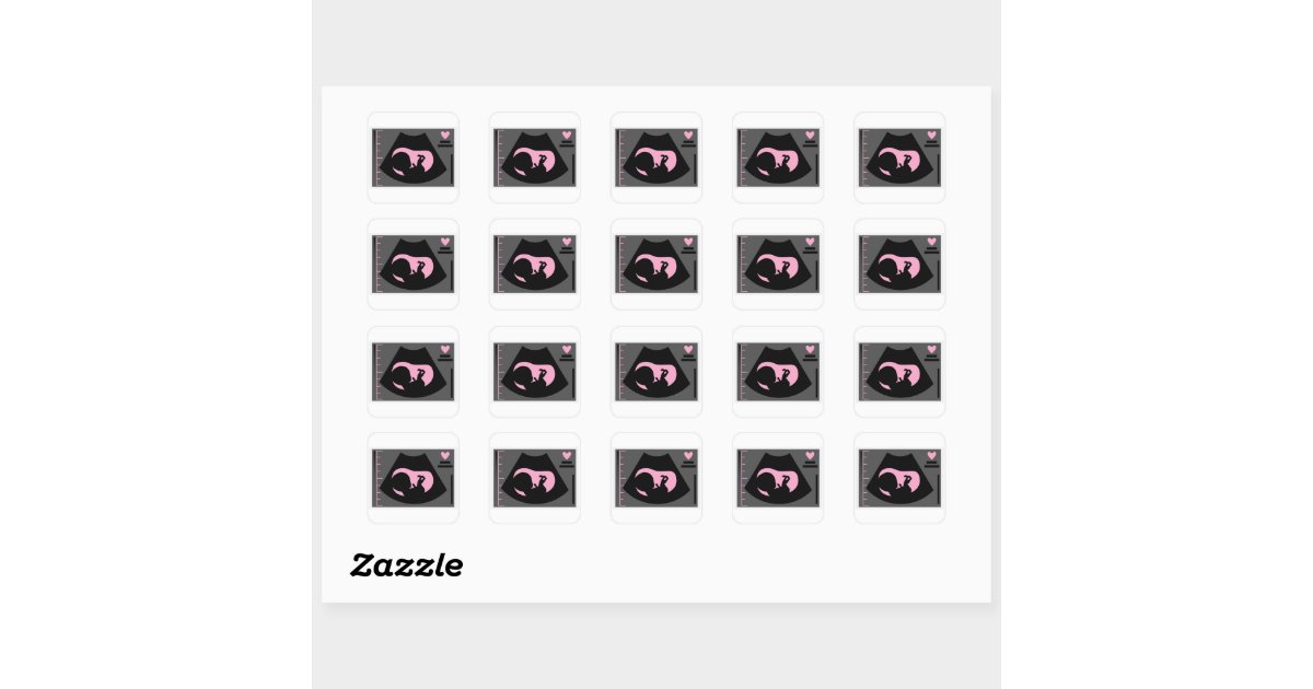 Cute Ultrasound Planner Stickers for IVF/IUI | Zazzle