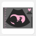 Cute Ultrasound Planner Stickers for IVF/IUI | Zazzle