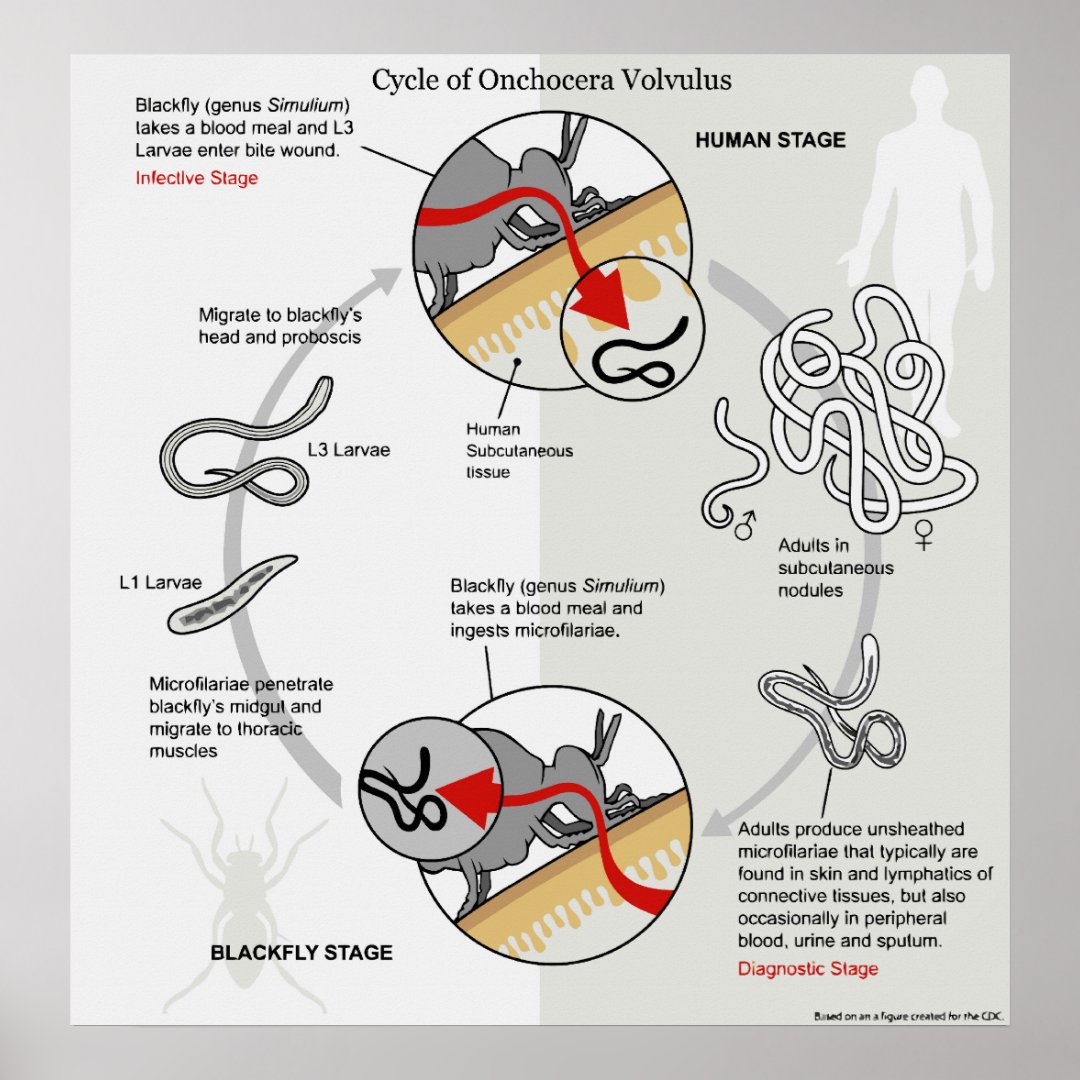 Diagram of The Life Cycle of Onchocerca Volvulus Poster | Zazzle