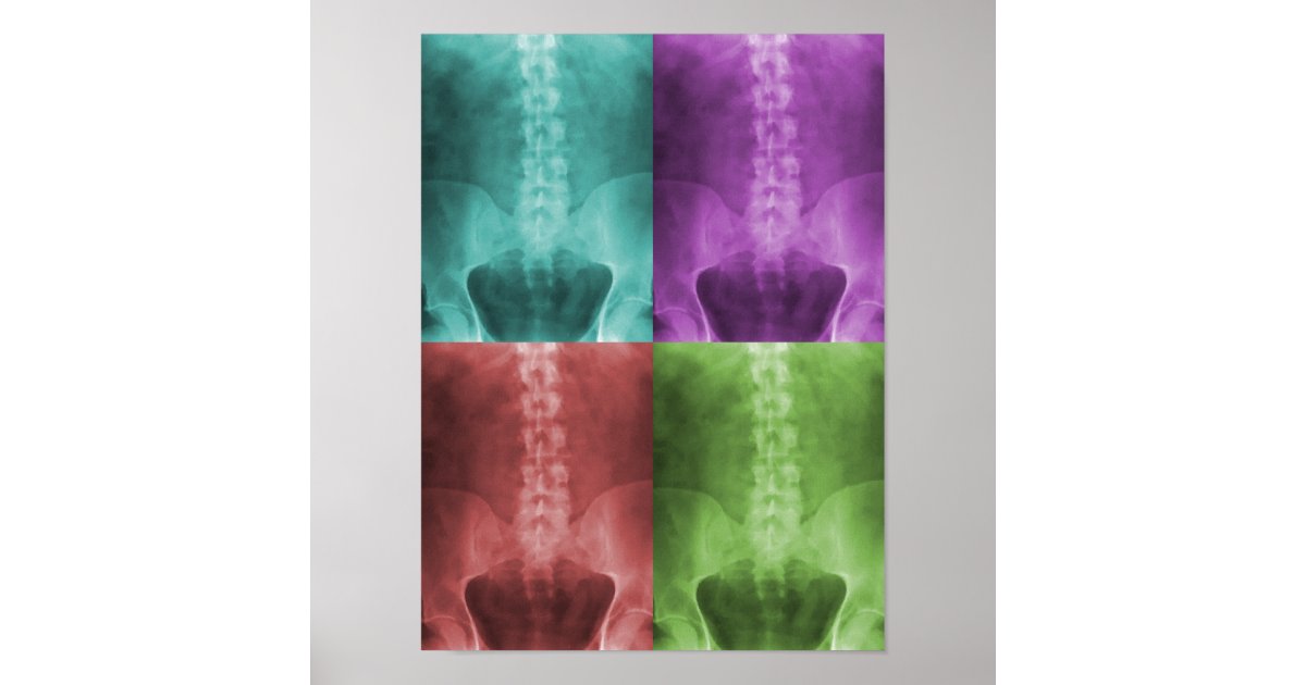 Digital X-Ray Art Canvas Poster | Zazzle