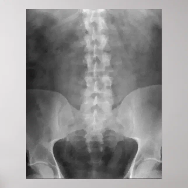 Digital X-Ray Art Print | Zazzle