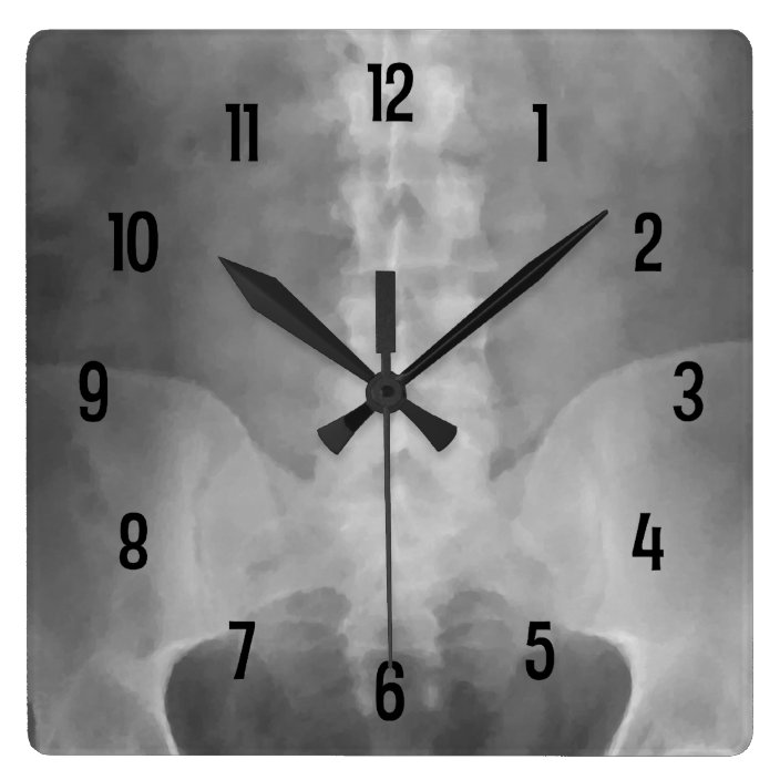Digital X-Ray Art Wall Clock | Zazzle.com