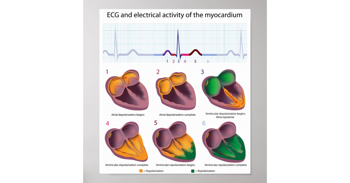 ECG heart electrical activity Poster | Zazzle