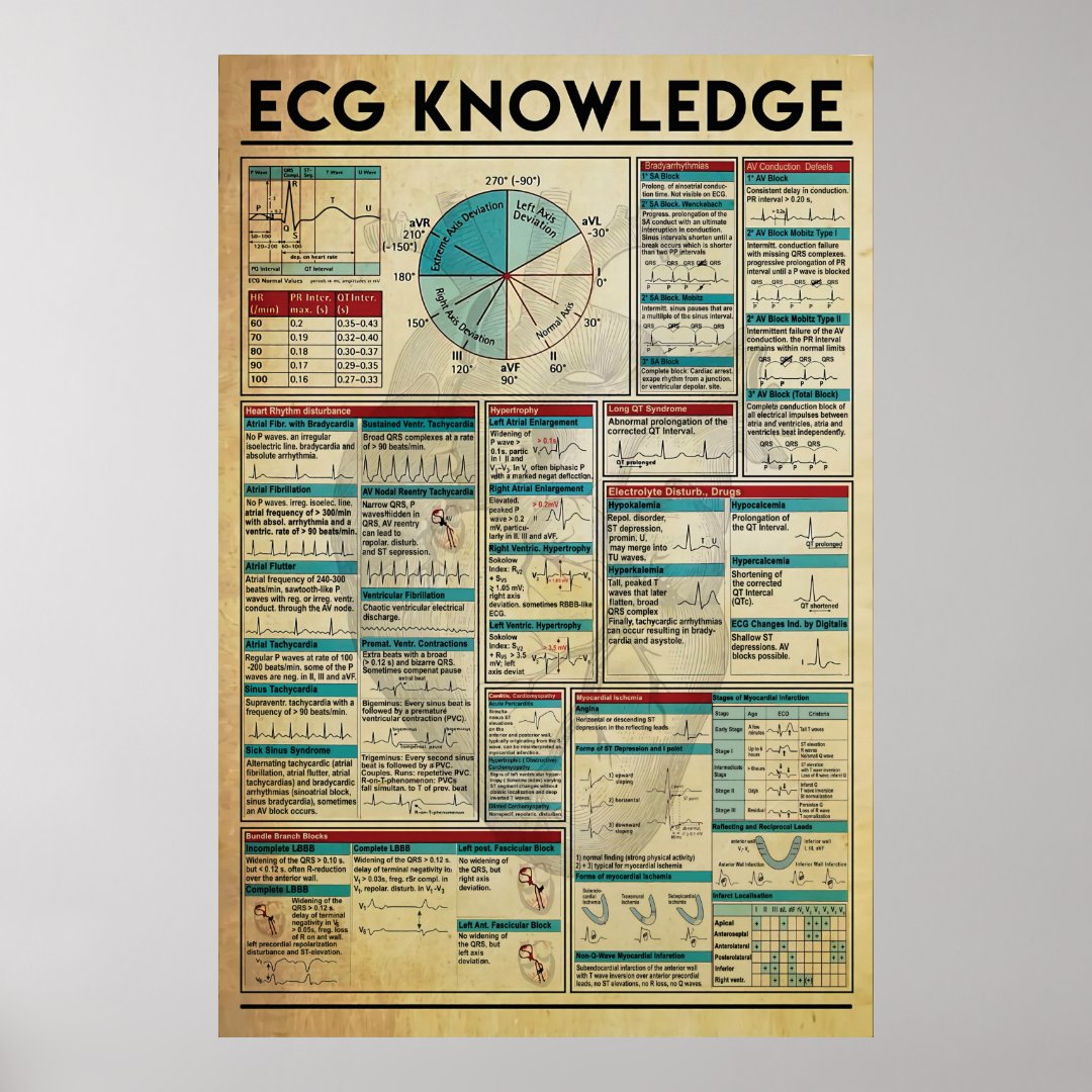 ECG Knowledge Poster, Cardiology Knowledge Poster | Zazzle