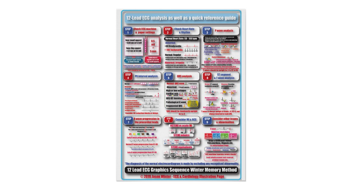 ECG Training Poster | Zazzle