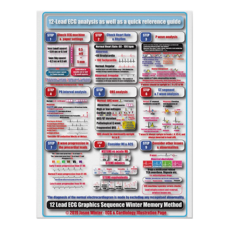ECG Training Poster | Zazzle