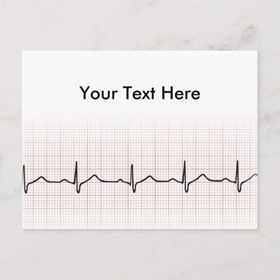 EKG heartbeat on graph paper, PhD (doctor) pulse Postcard | Zazzle