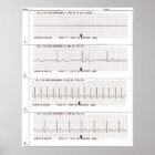 Rhythm Basics - Music Theory Classroom Poster | Zazzle.com