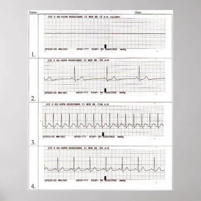 ekg Rhythms Poster | Zazzle