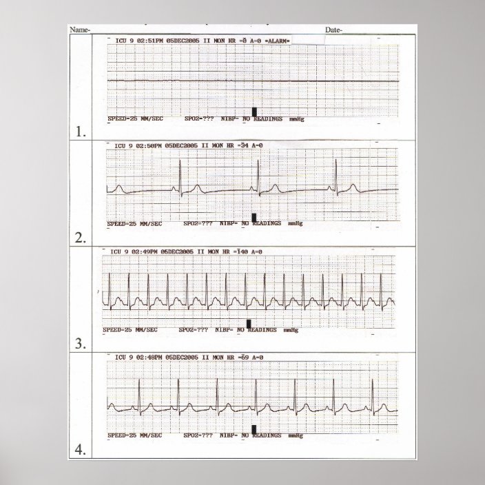 ekg Rhythms Poster | Zazzle.com