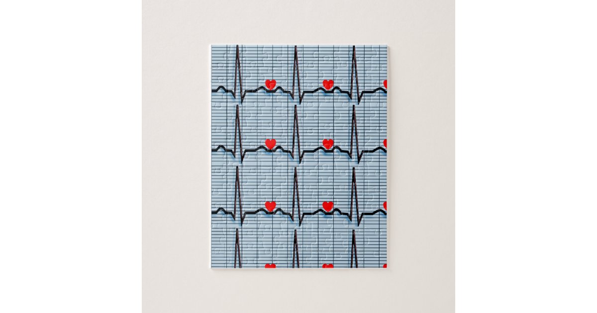 EKG Strips Jigsaw Puzzle | Zazzle