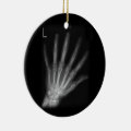 Extra Digit X-ray Left Hand Ceramic Ornament | Zazzle