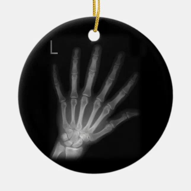 Extra Digit X-ray Left Hand Ceramic Ornament | Zazzle