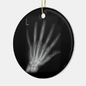 Extra Digit X-ray Left Hand Ceramic Ornament | Zazzle