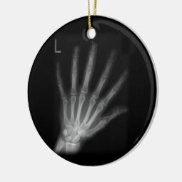 Extra Digit X-ray Left Hand Ceramic Ornament | Zazzle