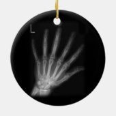 Extra Digit X-ray Left Hand Ceramic Ornament | Zazzle