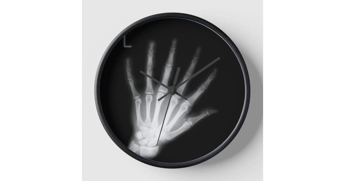 Extra Digit X-ray Left Hand Clock | Zazzle