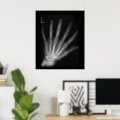 Extra Digit X-ray Left Hand Poster | Zazzle
