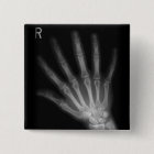 Shaka Sign X-Ray (Hang Loose) Button | Zazzle.com