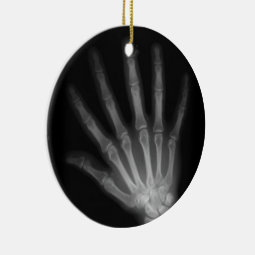 Extra Digit X-ray Right Hand Ceramic Ornament | Zazzle