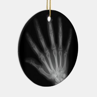 Extra Digit X-ray Right Hand Ceramic Ornament | Zazzle