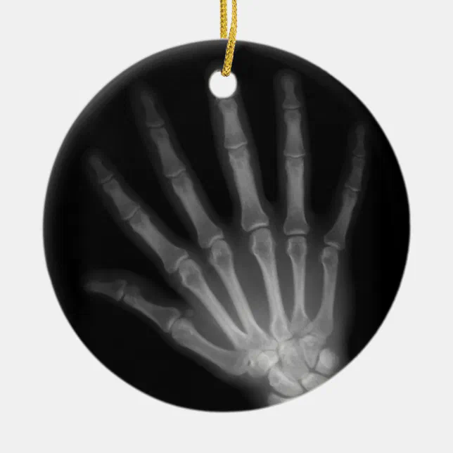 Extra Digit X-ray Right Hand Ceramic Ornament | Zazzle