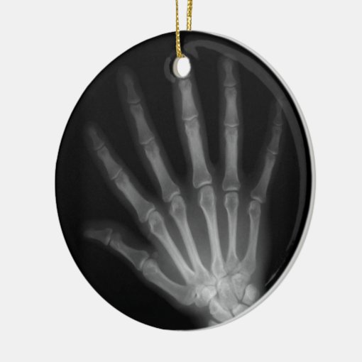 Extra Digit X-ray Right Hand Ceramic Ornament | Zazzle