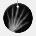 Extra Digit X-ray Right Hand Ceramic Ornament | Zazzle