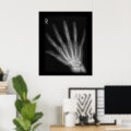Extra Digit X-ray Right Hand Poster | Zazzle