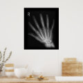 Extra Digit X-ray Right Hand Poster | Zazzle