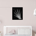 Extra Digit X-ray Right Hand Poster | Zazzle