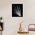 Extra Digit X-ray Right Hand Poster | Zazzle