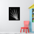 Extra Digit X-ray Right Hand Poster | Zazzle