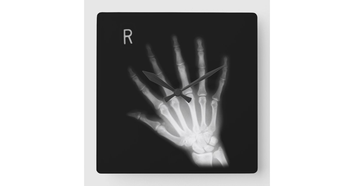 Extra Digit X-ray Right Hand Square Wall Clock | Zazzle