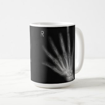 Extra Digit X-ray Right & Left Hands Coffee Mug | Zazzle