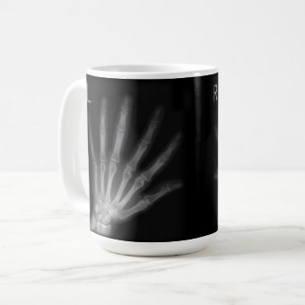 Extra Digit X-ray Right & Left Hands Coffee Mug | Zazzle