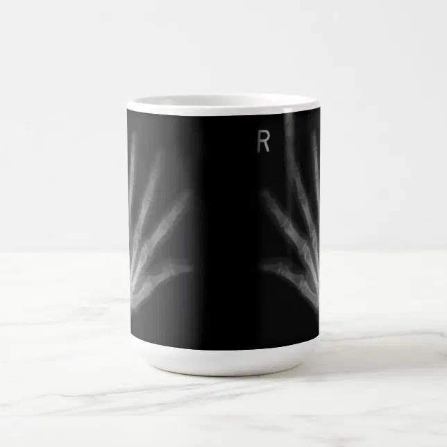 Extra Digit X-ray Right & Left Hands Coffee Mug | Zazzle