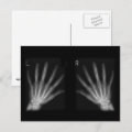 Extra Digit X-ray Right & Left Hands Postcard | Zazzle