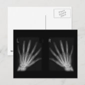Extra Digit X-ray Right & Left Hands Postcard | Zazzle