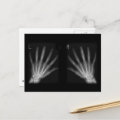 Extra Digit X-ray Right & Left Hands Postcard | Zazzle