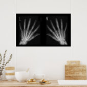 Extra Digit X-ray Right & Left Hands Poster | Zazzle