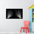 Extra Digit X-ray Right & Left Hands Poster | Zazzle