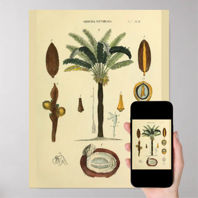 Eye Muscles Palm Tree Anatomy Art Print | Zazzle