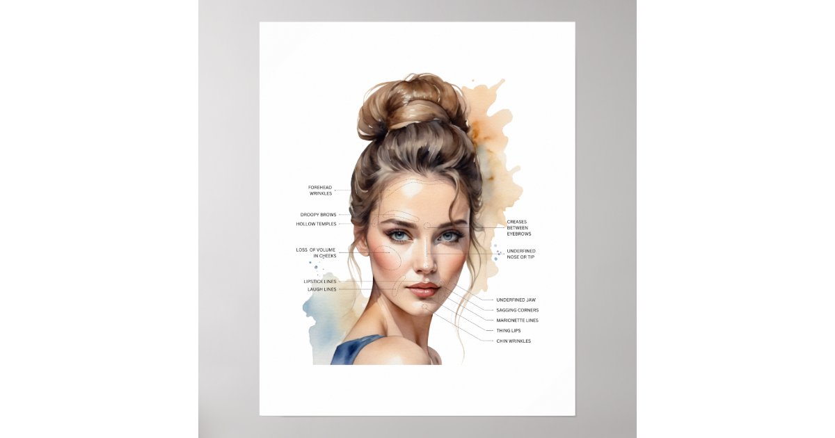 Face Map For Dermal Filler And Botox Poster | Zazzle