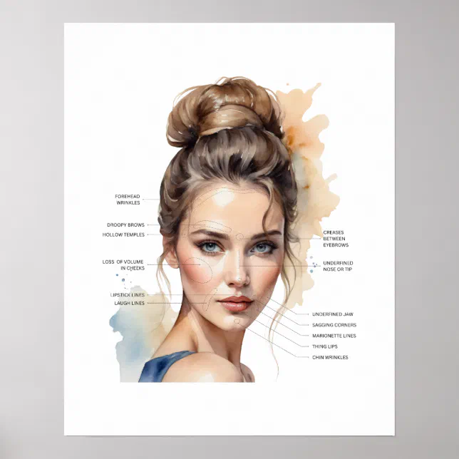 Face Map For Dermal Filler And Botox Poster | Zazzle