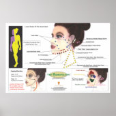 Facial Cupping Poster | Zazzle